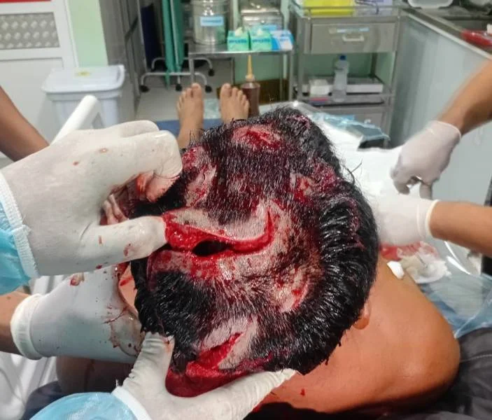 Cacique quase foi escalpelado em ataque de onça ao meio dia de domingo ...